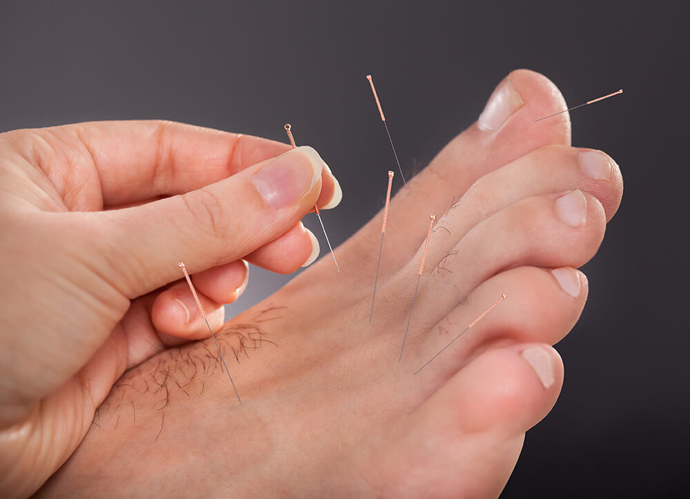 Services | Podiatry Orthotics Ingrown Toenails Skin Care Dry Needling ...